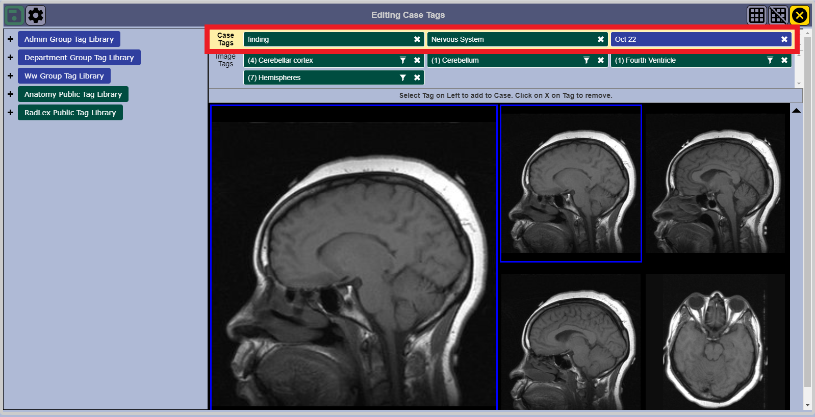 Tags - RadPix Radiology Teaching File Software